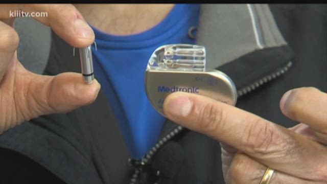 kiiitv.com | Cardiologists perform first micro-Pacemaker implant in ...